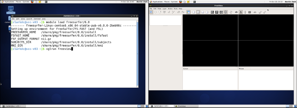 ((TOP)) Freesurfer-tutorial